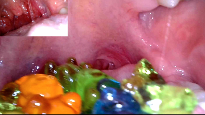 Giantess Debora Vore Gummy Bears Endoscopy Manyvids