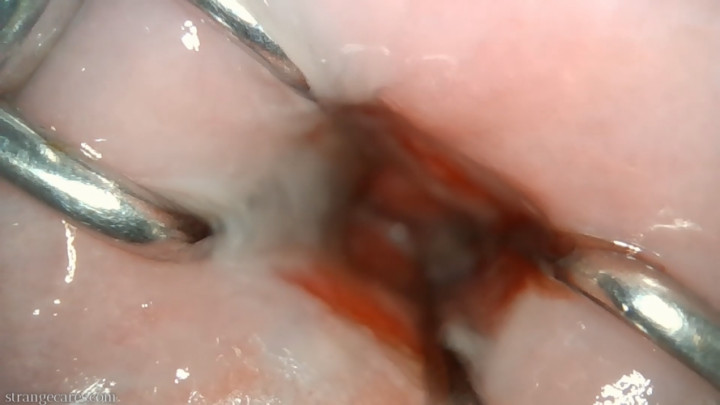 Strangecares Shrinking You To Stuff You In My Cervix Manyvids