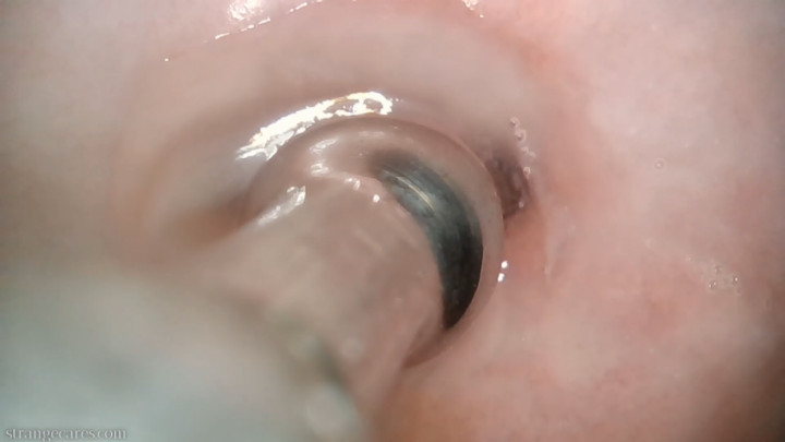 Strangecares Juicy Cervix Sounding Manyvids