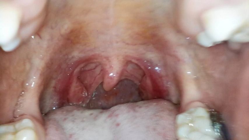 Luciana3c Mouth And Uvula Fetish Manyvids