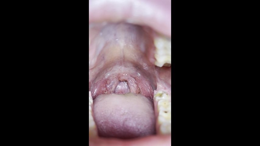 Alice Wht The Girl Shows Her Uvula Teeth Close Up Manyvids
