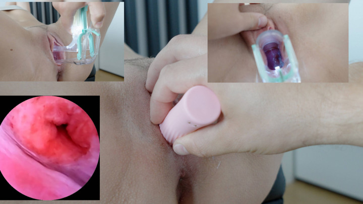 Medicalbdsm Speculum Cervix Close Up Manyvids