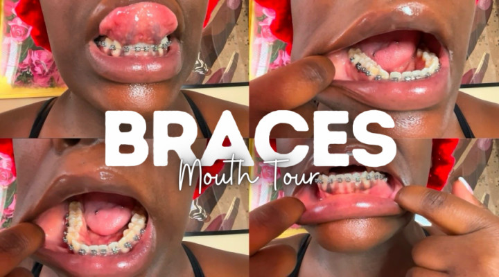 Goddessaminaaxo Braces Mouth Tour Manyvids