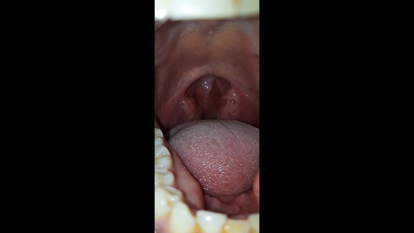 Liloshiru Dangly Uvula Manyvids