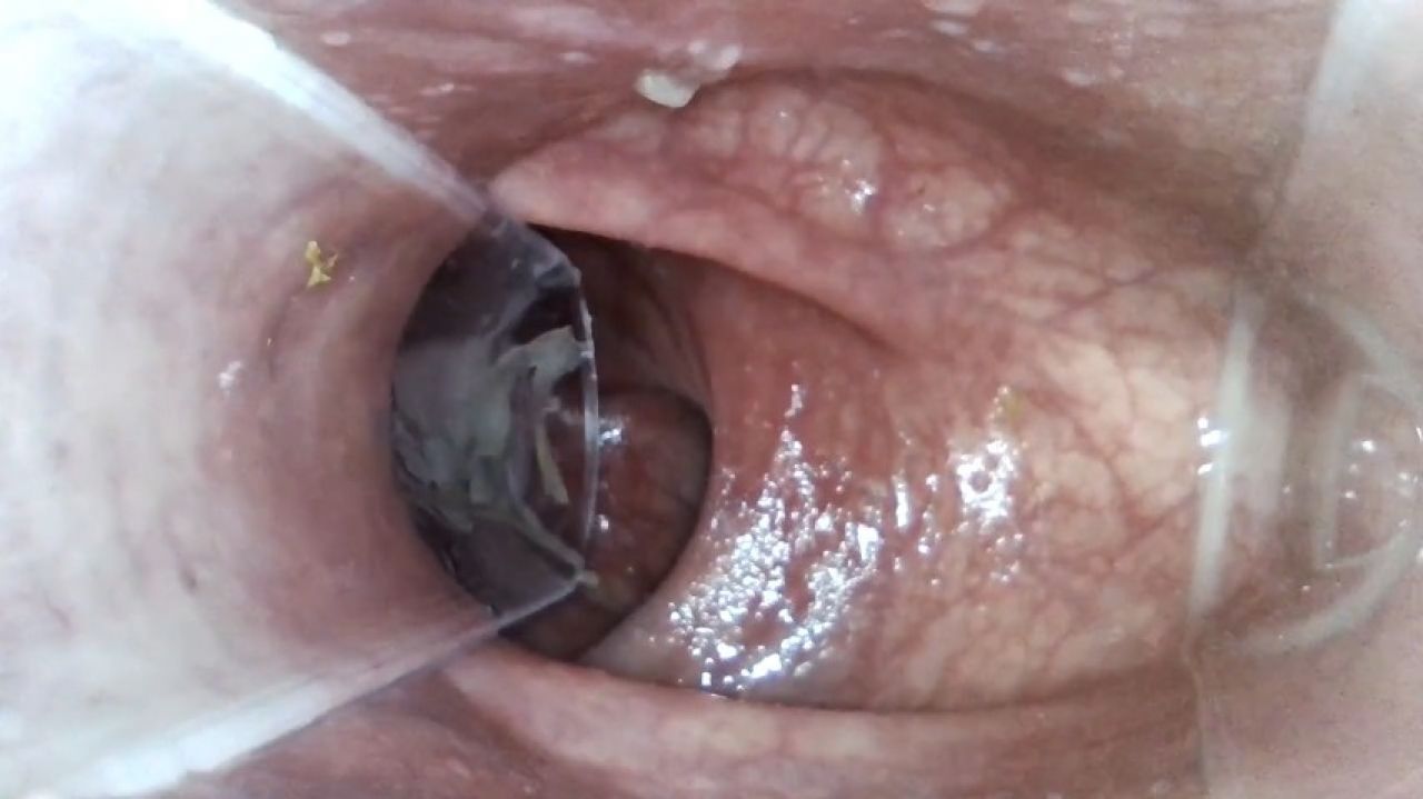 Yaha Ferh Anal And Vaginal Endoscope Manyvids
