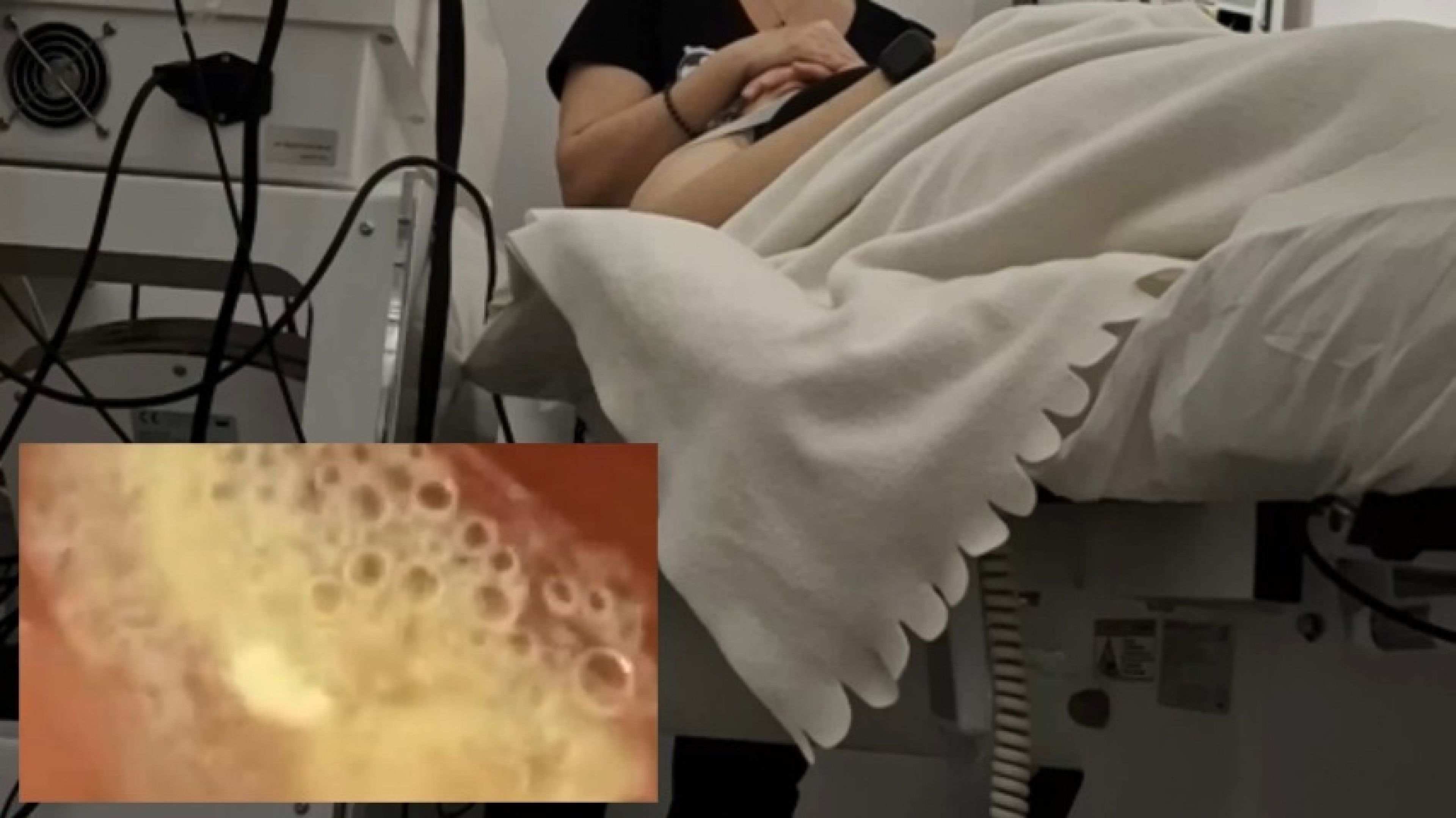 Colette Fetish Vore Exploration With Pillcam At The Medical Center