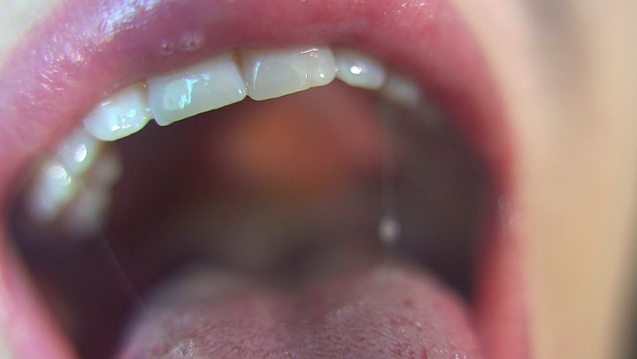 Rarible Diamond Lips Over You Custom Manyvids